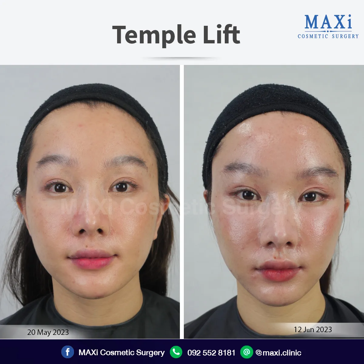 MAXi Cosmetic Surgery Takes Care Of Every Detail. - MAXi Cosmetic Surgery