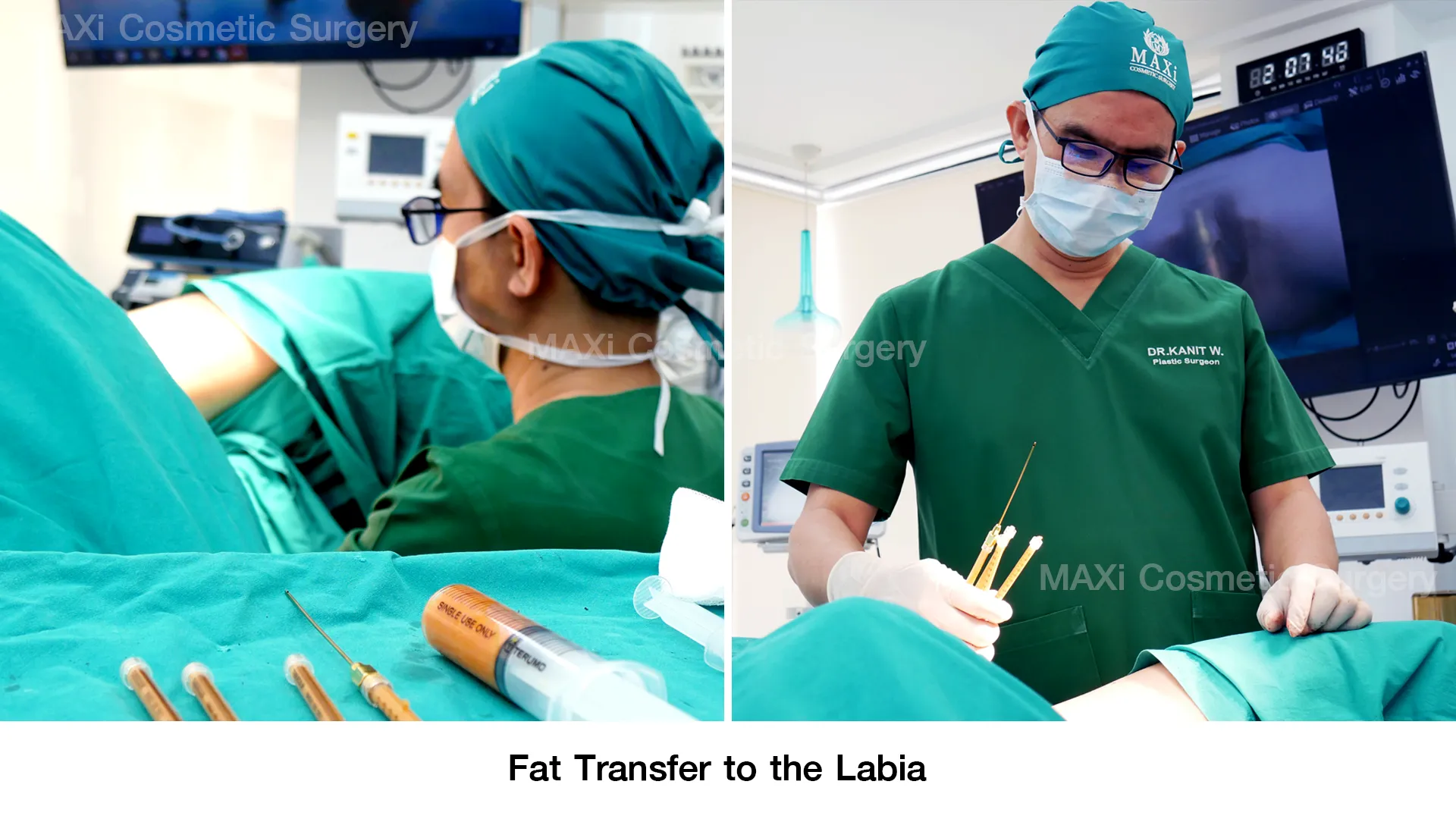 Labiaplasty in Thailand | MAXi Clinic by Dr. Kanit - MAXi Cosmetic Surgery