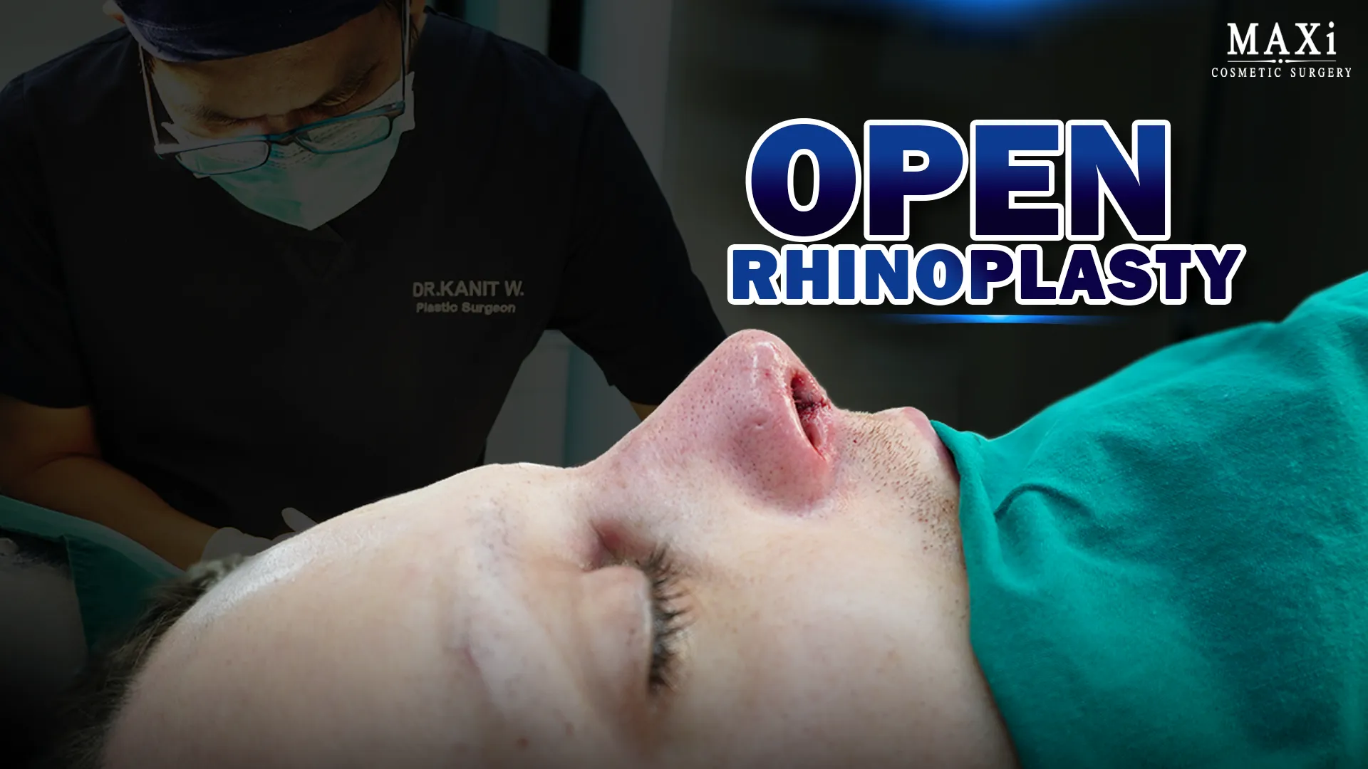 Rhinoplasty - Nose Surgery Natural results - MAXi Cosmetic Surgery